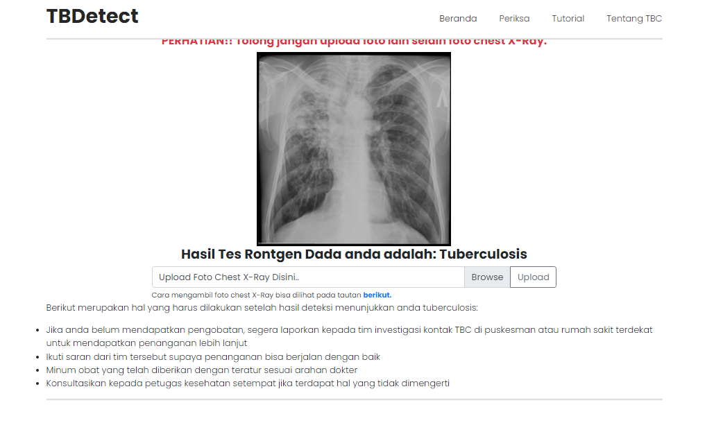 GitHub - brnsbrn/TBDetect: Application that can define someone with tuberculosis using chest x-ray