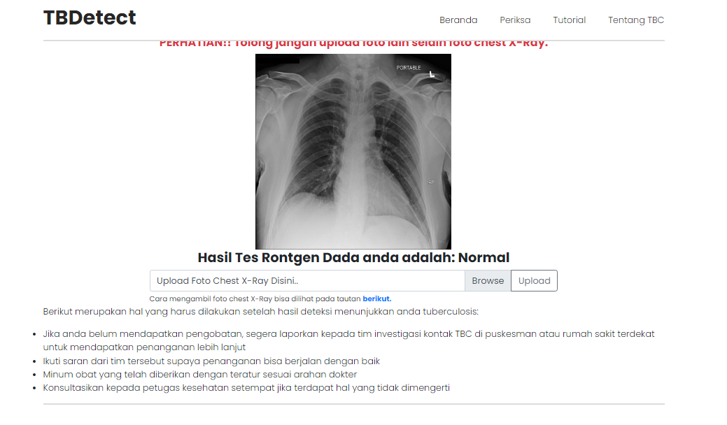 GitHub - brnsbrn/TBDetect: Application that can define someone with tuberculosis using chest x-ray