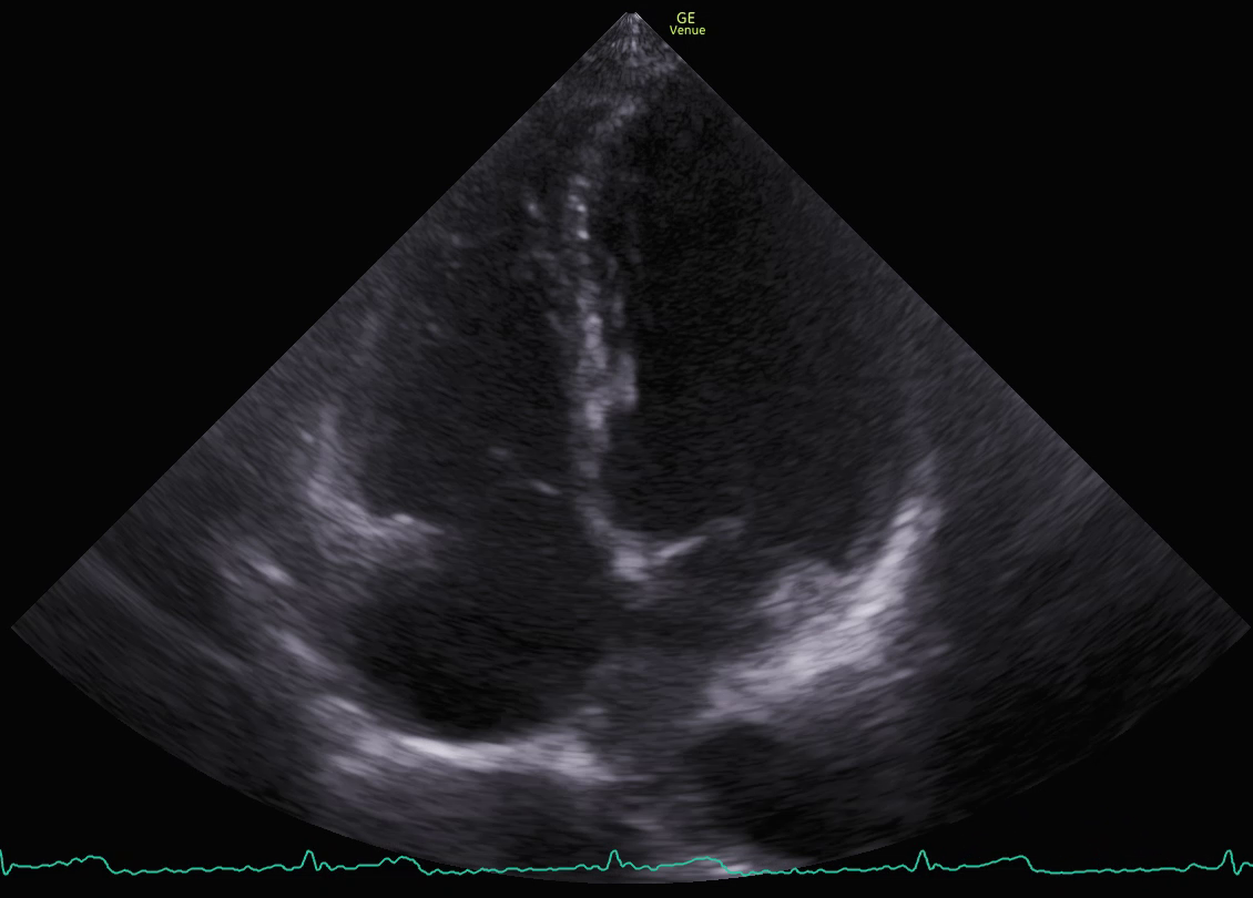 Curation, selection and validation of 4CV frame labels · Issue #21 · vital-ultrasound/ai ...