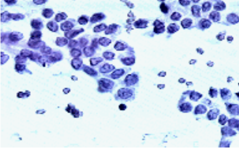 GitHub - Shashank-Reddy-M/Detecting-Cancer-in-Breast-Cells