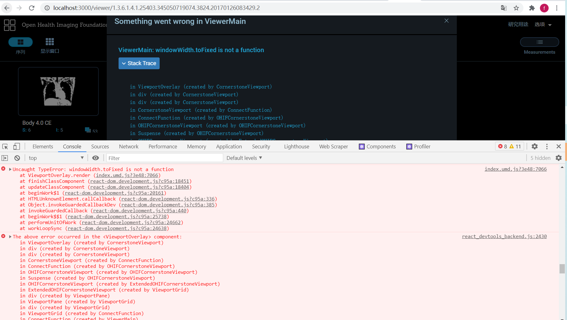 Viewer error :ToolbarRow: e.find(...) is undefined · Issue #2354 · OHIF/Viewers · GitHub