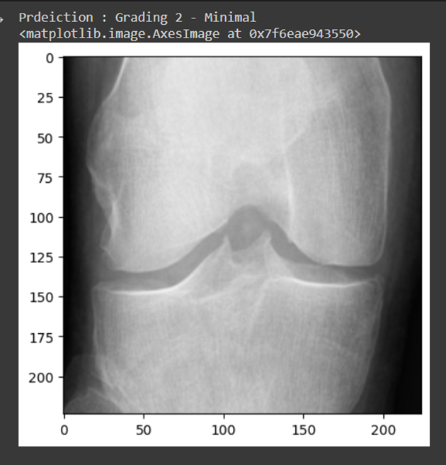 GitHub - Abinaya-0206/Knee-Oesteoarthritis-Prediction