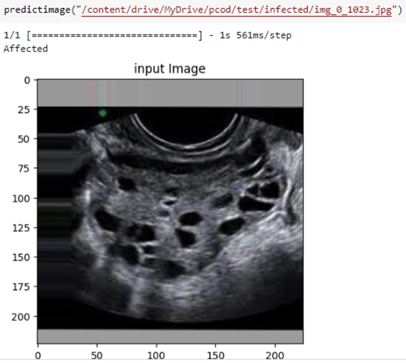 Github Jyots9 Pcos Detection