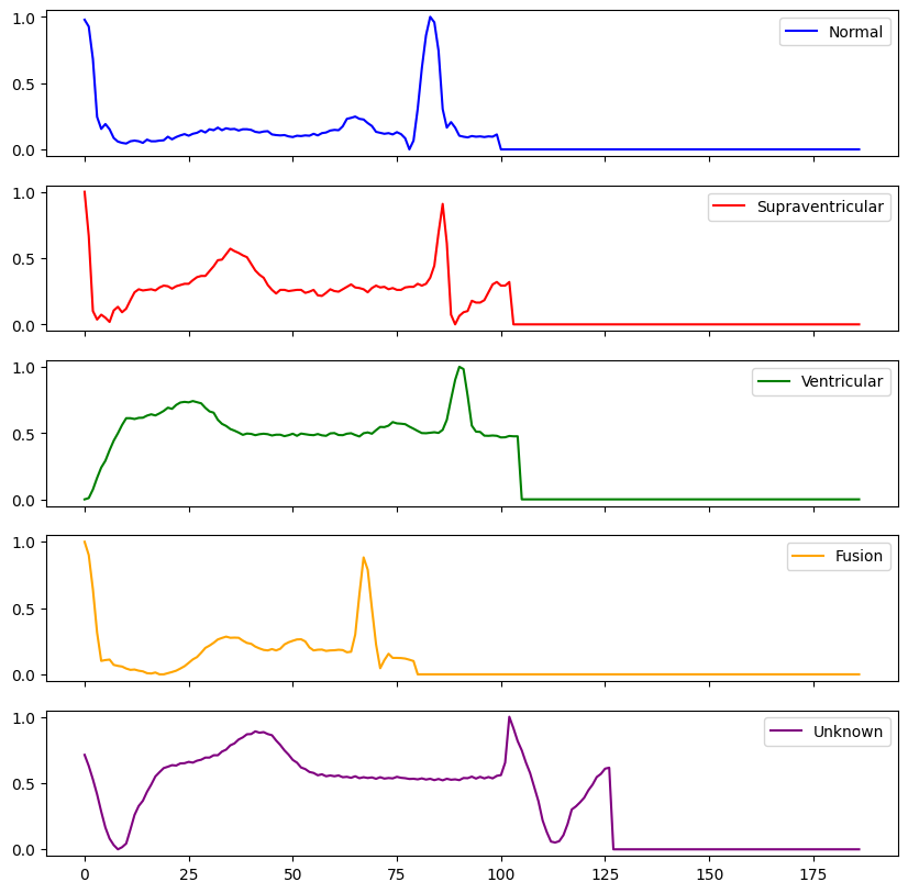 GitHub - vishnukarikalan07/ECG-CLASSIFICATION-INTELONE
