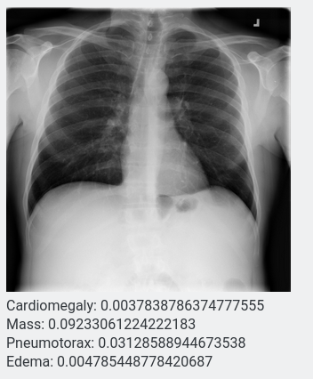 GitHub - jordimassaguerpla/chestxray.ai