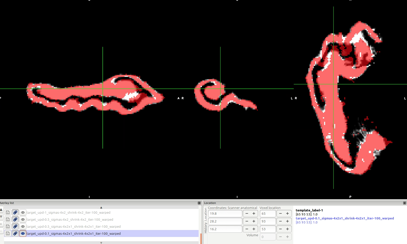 Optimize use of manual label map · Issue #11 · khanlab/hippunfold · GitHub