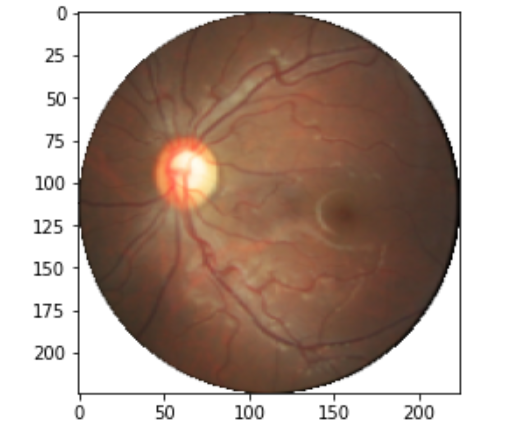 GitHub - Huangsh0225/Left-and-Right-Classification