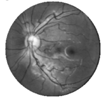 GitHub - Huangsh0225/Left-and-Right-Classification