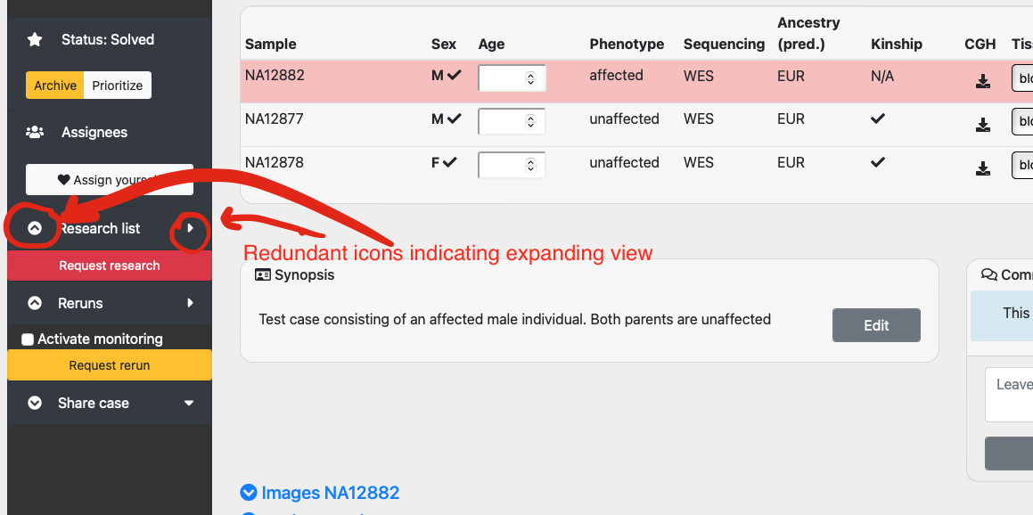 Share Case Icon Doesnt Show On Case Side Bar Unless You Click On It