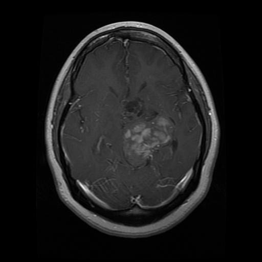 GitHub - yewonkim01/opensource_sw_final