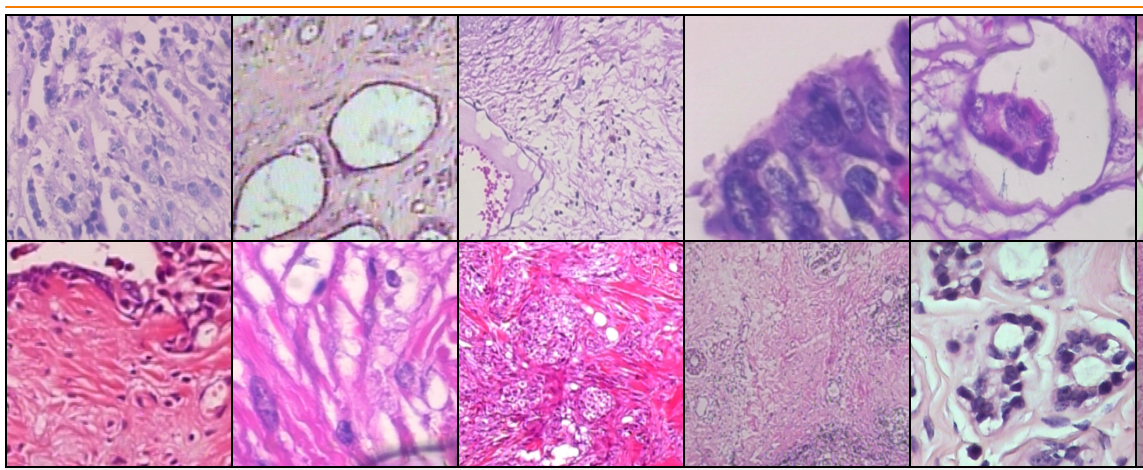 Github Bittupanchalbreast Cancer Detection Using Decision Tree Machine Learning Classifier