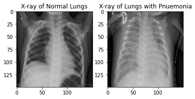 GitHub - KWKIM128/Pneumonia-Detection: Pneumonia Detection using CNN ...