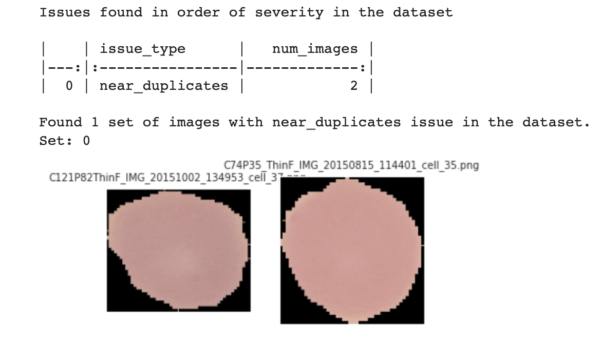 GitHub - 88ngreen88/Using_CNN_To_Diagnose_Malaira