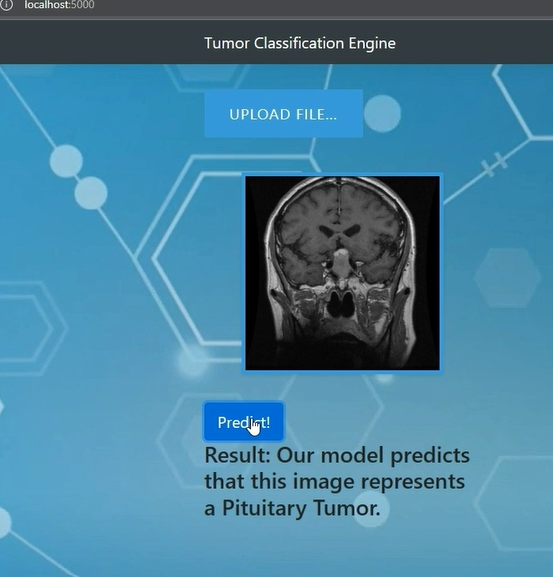 GitHub - ngirdharry/Brain-Tumor-Detection-using-Machine-Learning-and-MRI-Images