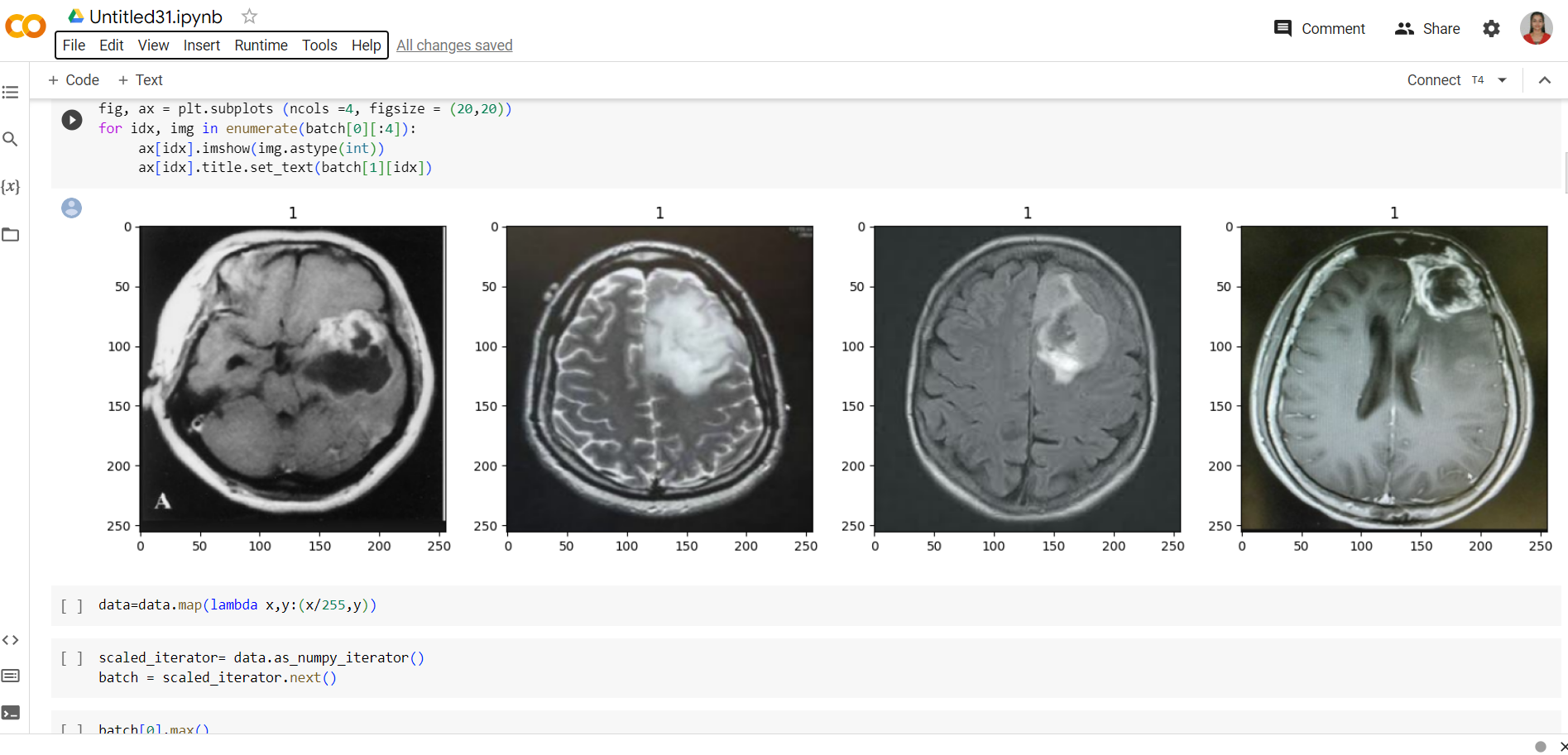 GitHub - Srinithi2501/MRI_AR: RADIOLOGY USING AUGMENTED REALITY
