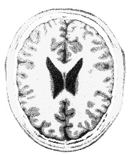 GitHub - sithija-vihanga/Image-processing-and-machine-vision: Related to Image processing and ...