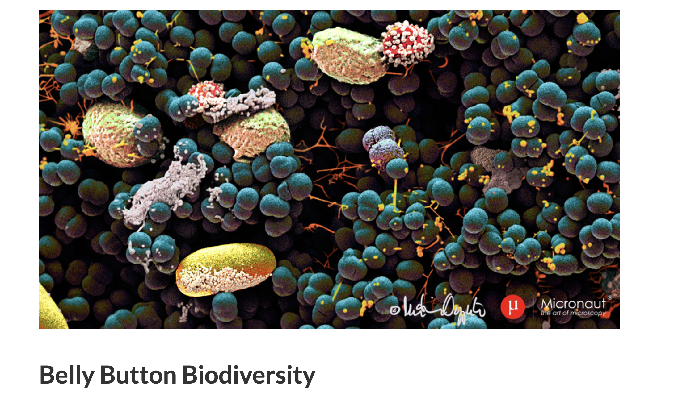 GitHub - MeerKar/Belly-Button-JS: An interactive dashboard is built to explore the Belly Button ...