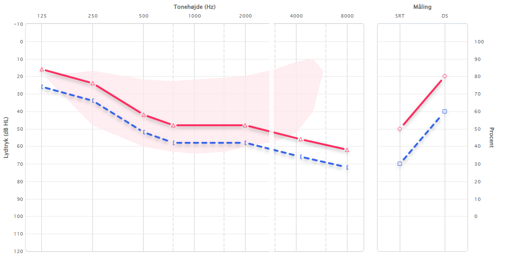 scrollablePlotArea's highcharts-scrollable-mask stopping at (first?) highcharts-treegrid-node ...