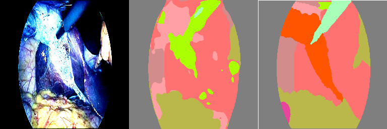 GitHub - ssaserkar/Endoscope_DVRK_GazeTracking: Automating the ...