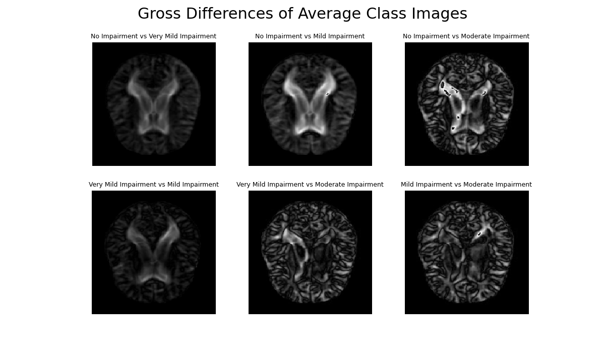 GitHub - LucasFishbein/Alzheimer-Severity-From-MRI-Model: Alzheimer MRI ...