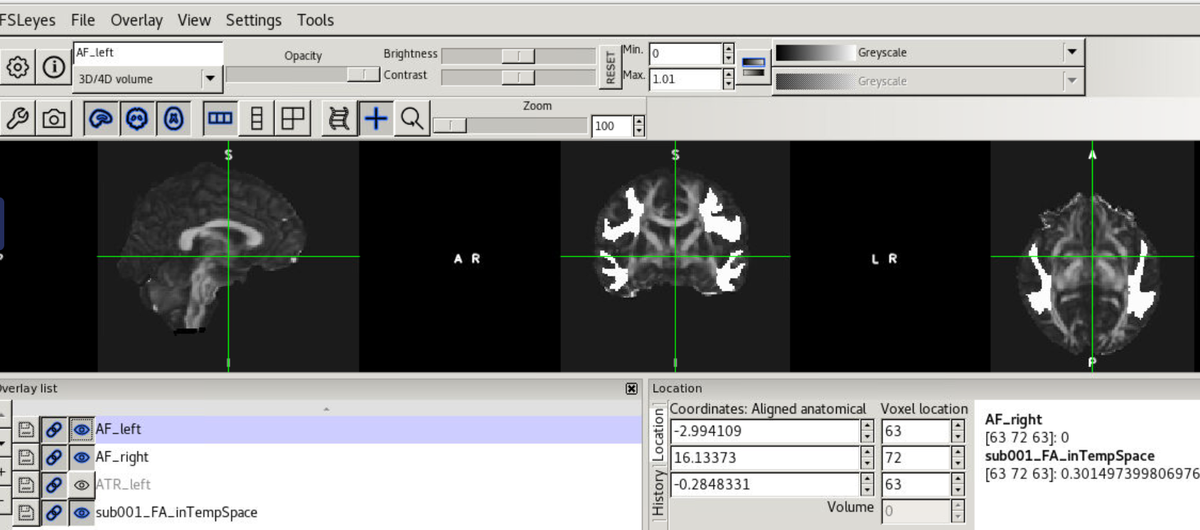 Calculate mean FA of a specific tract · Issue #212 · MIC-DKFZ/TractSeg · GitHub