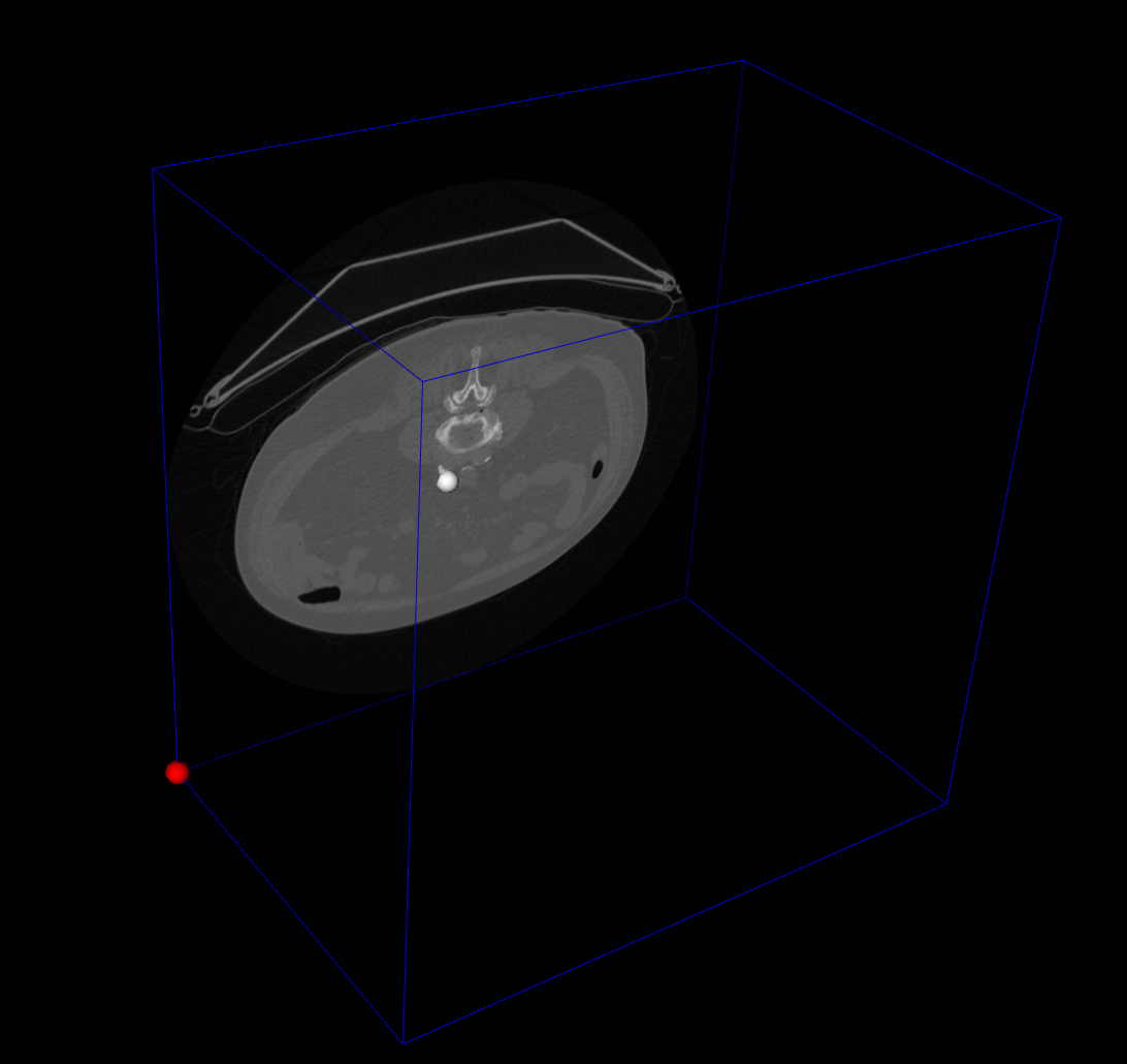 Bounds Computation With Vtkimageslice Actor · Issue 284 · Kitwarevtk Js · Github