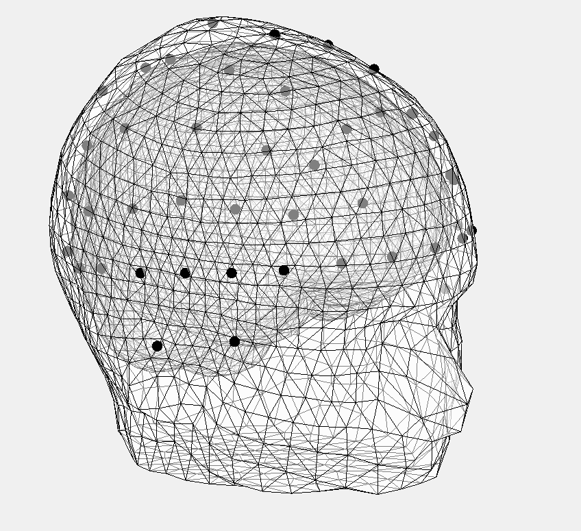 Ftelectroderealign Project Not Projecting · Issue 2136 · Fieldtripfieldtrip · Github