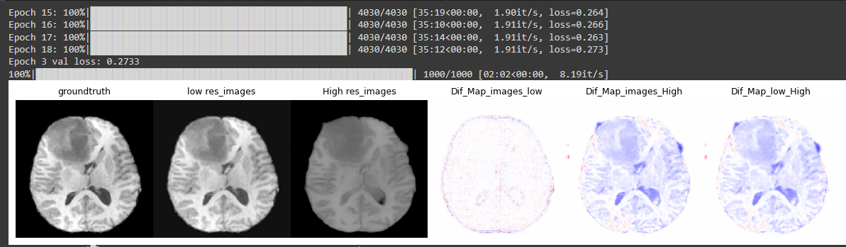 why my loss function in diffusion Model doesnt get improved? · Issue #394 · Project-MONAI ...