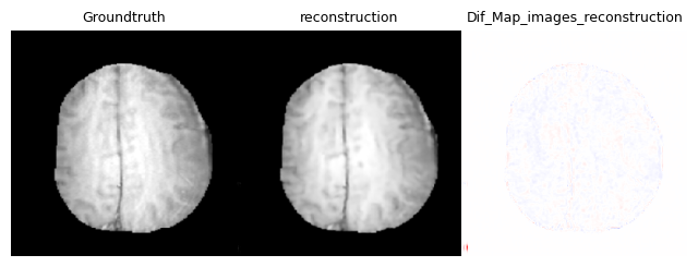 Why My Loss Function In Diffusion Model Doesnt Get Improved · Issue