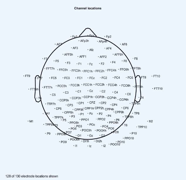 EEGLAB preprocessing troubles · Issue #552 · sccn/eeglab · GitHub