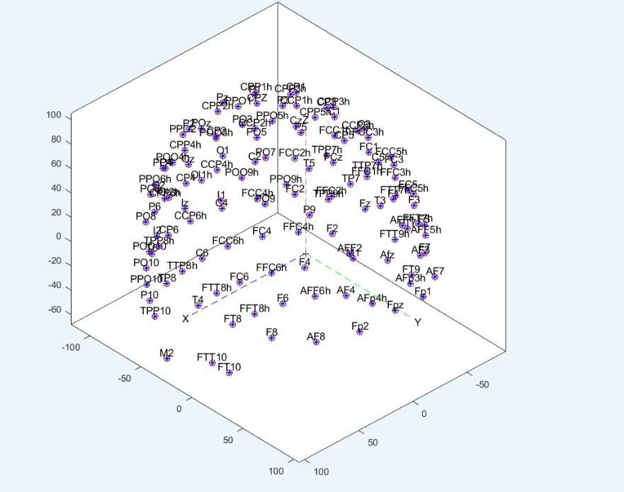 EEGLAB preprocessing troubles · Issue #552 · sccn/eeglab · GitHub