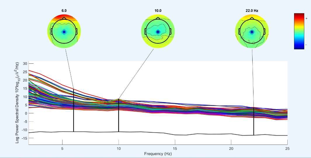 EEGLAB preprocessing troubles · Issue #552 · sccn/eeglab · GitHub