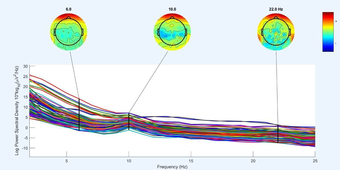 EEGLAB preprocessing troubles · Issue #552 · sccn/eeglab · GitHub