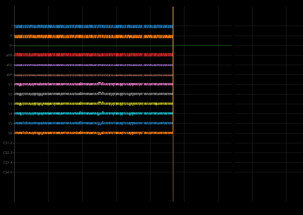 Is It Possible To Shift Signalplot On The X Axis · Scottplot Scottplot · Discussion 2211 · Github 0752