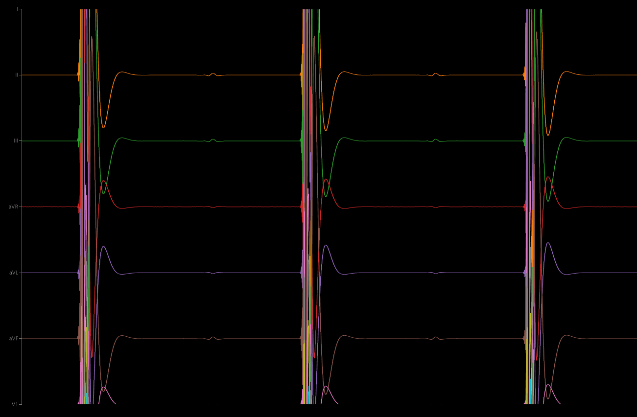 How to scale and limit the vertical space of a multi-signal plot · ScottPlot ScottPlot ...