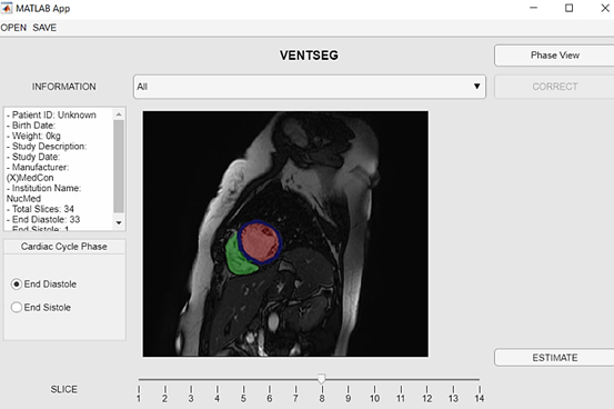 GitHub - JulioSoteloParraguez/VENTSEG-ventricular_segmentation ...