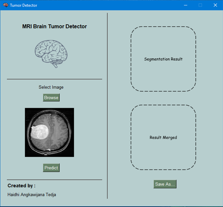 GitHub - haidhiSkuy/UNet-PySimpleGui: Simple python app for brain tumor detectition using image ...