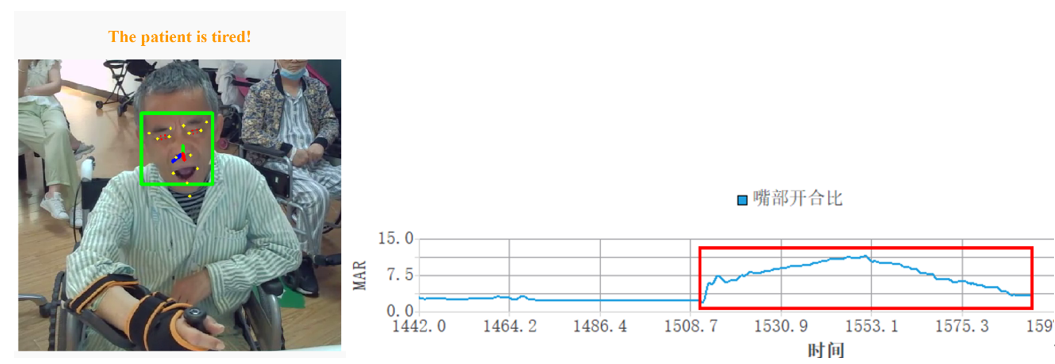 GitHub - ZoeEsther/StrokePatients_Fatigue_Detection: This project realizes fatigue detection of ...