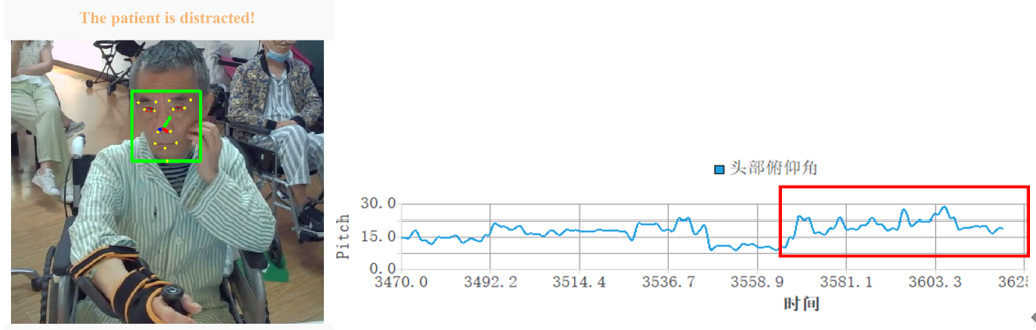 GitHub - ZoeEsther/StrokePatients_Fatigue_Detection: This project ...