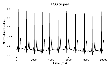 GitHub - gilad-altshuler/ECG-classification: depository for deep ...