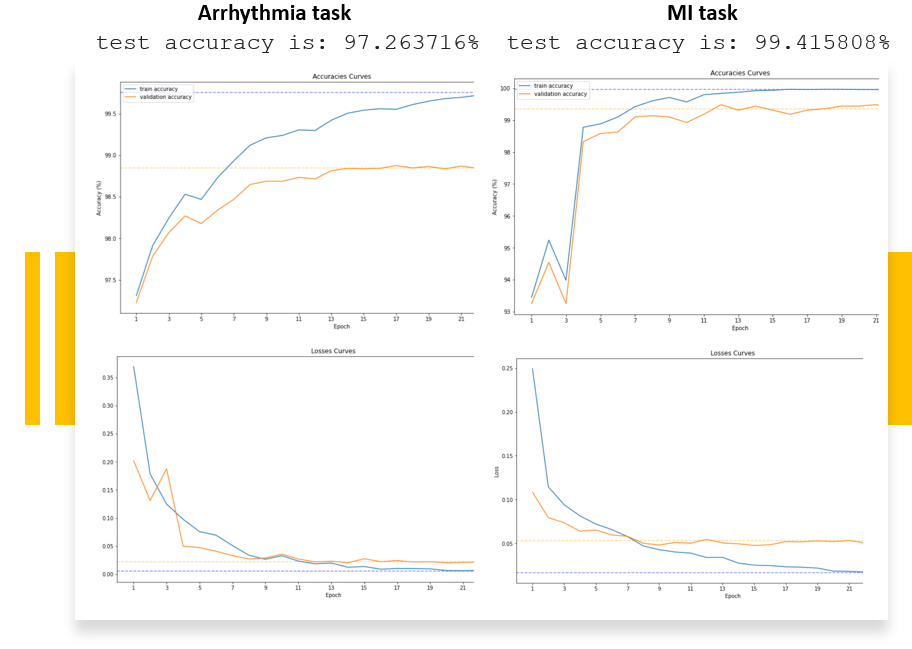 GitHub - gilad-altshuler/ECG-classification: depository for deep ...