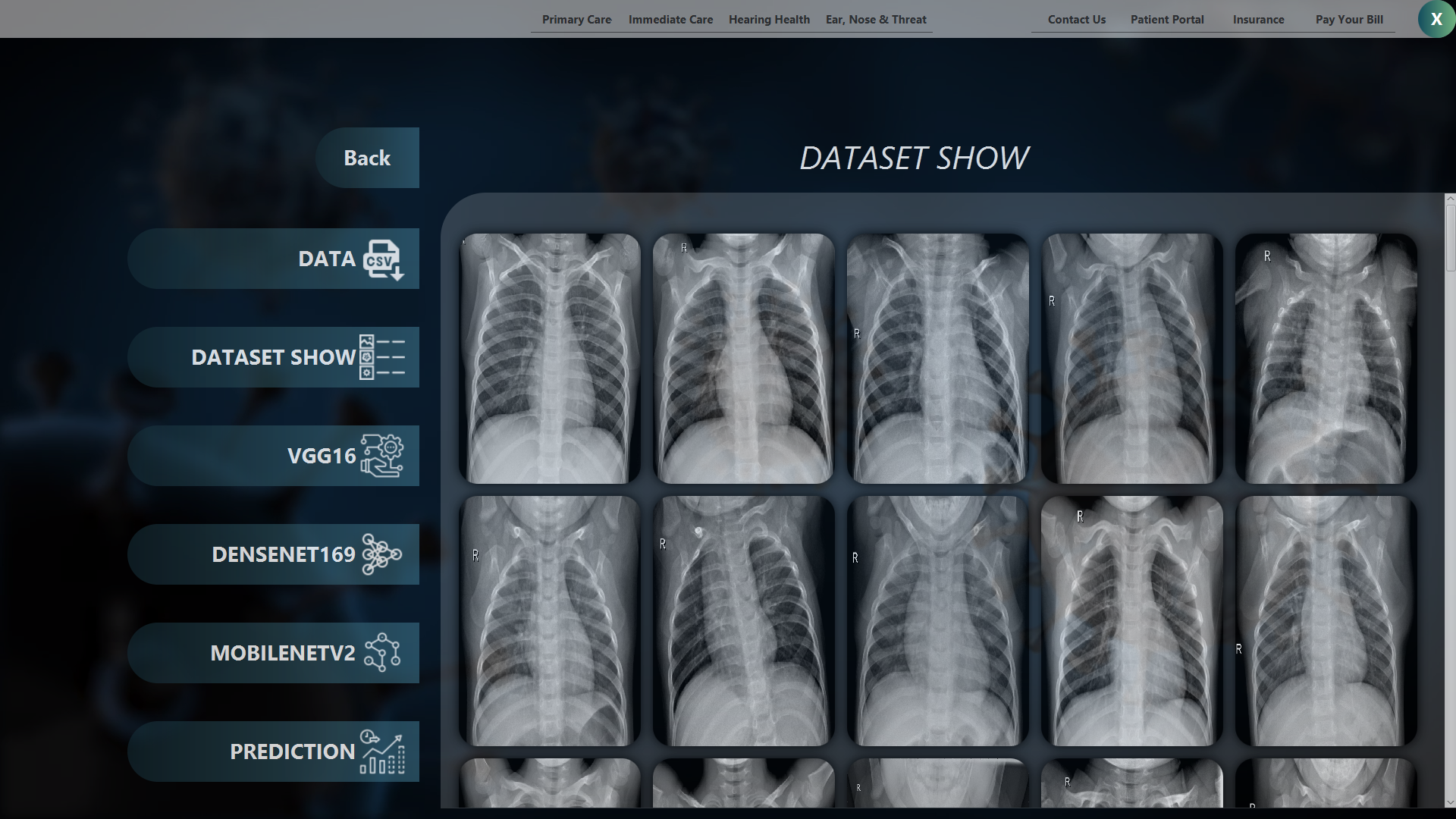 GitHub - ritikajain-134/Detection-of-Pneumonia-in-Thoracic-Radiographic-Images-Using-A-Deep ...