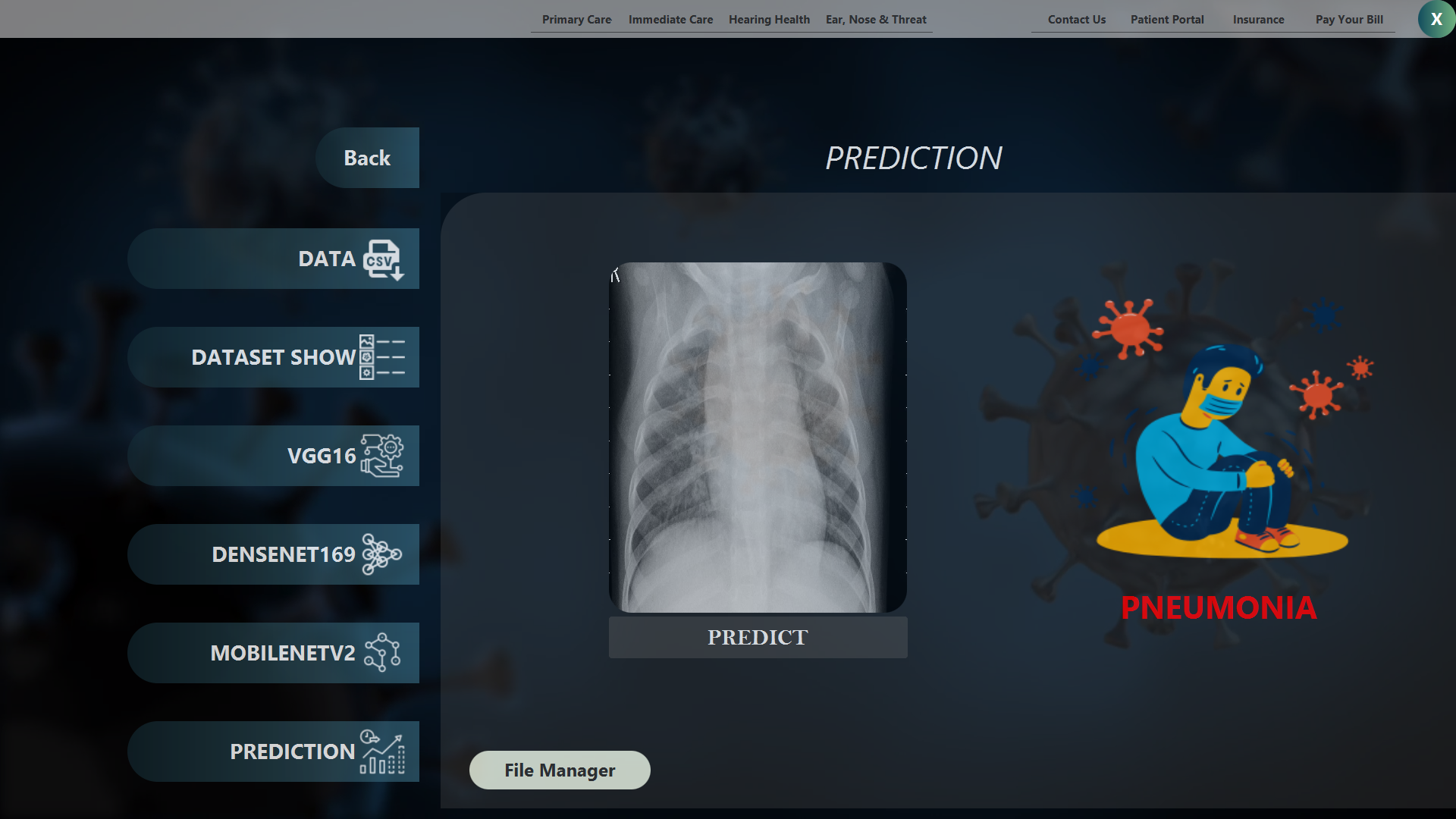 Github Ritikajain 134 Detection Of Pneumonia In Thoracic Radiographic