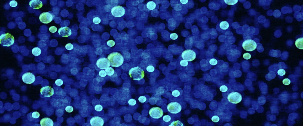 GitHub - michelleowino/belly-button-analysis: An interactive dashboard to explore the Belly ...