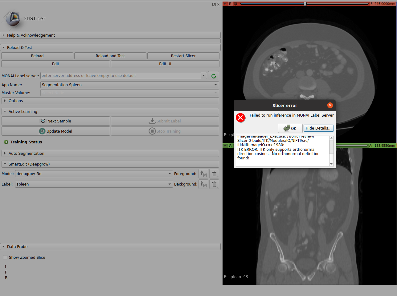 [slicer] Itk Reader Orthonormal Direction Cosines · Issue 35 · Project Monai Monailabel · Github