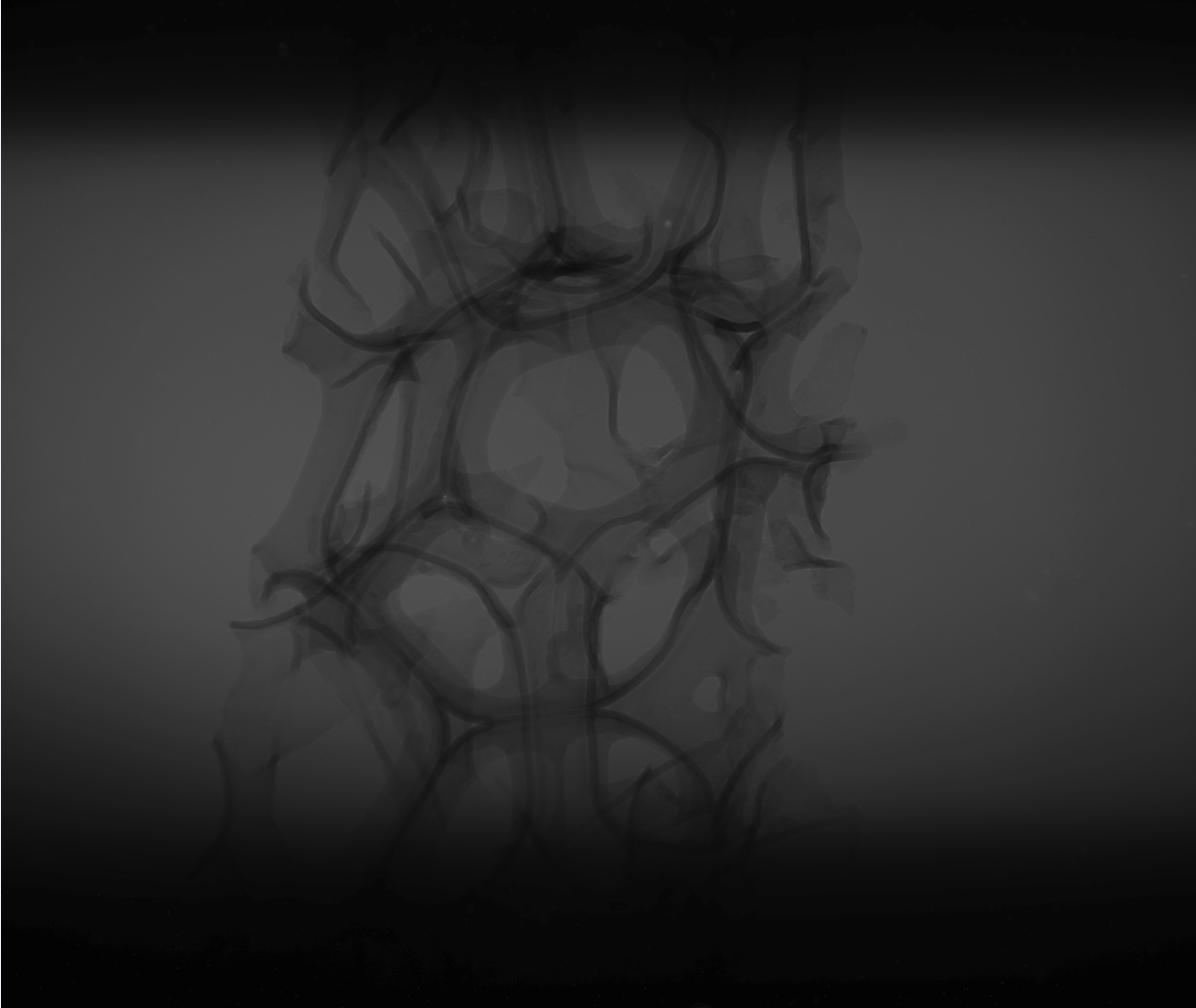 Trying 3D Reconstructruction of Metal foam from 2D Projections (X-ray images) but facing issue ...