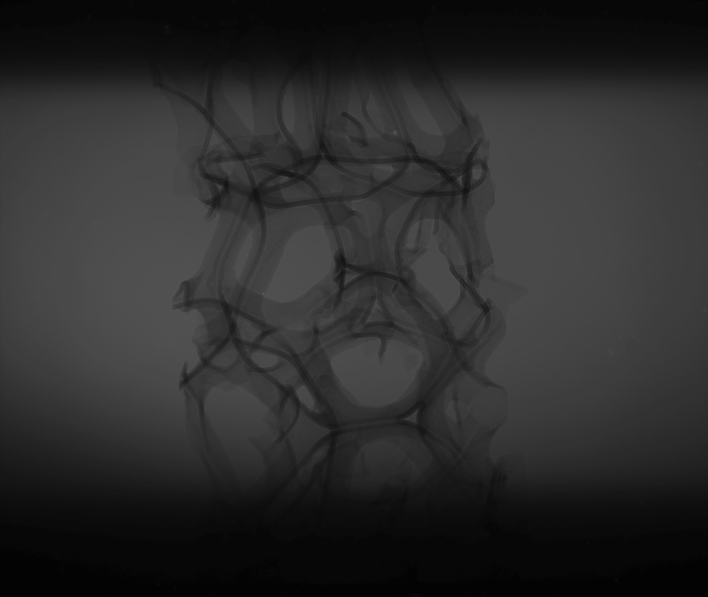 Trying 3D Reconstructruction of Metal foam from 2D Projections (X-ray images) but facing issue ...