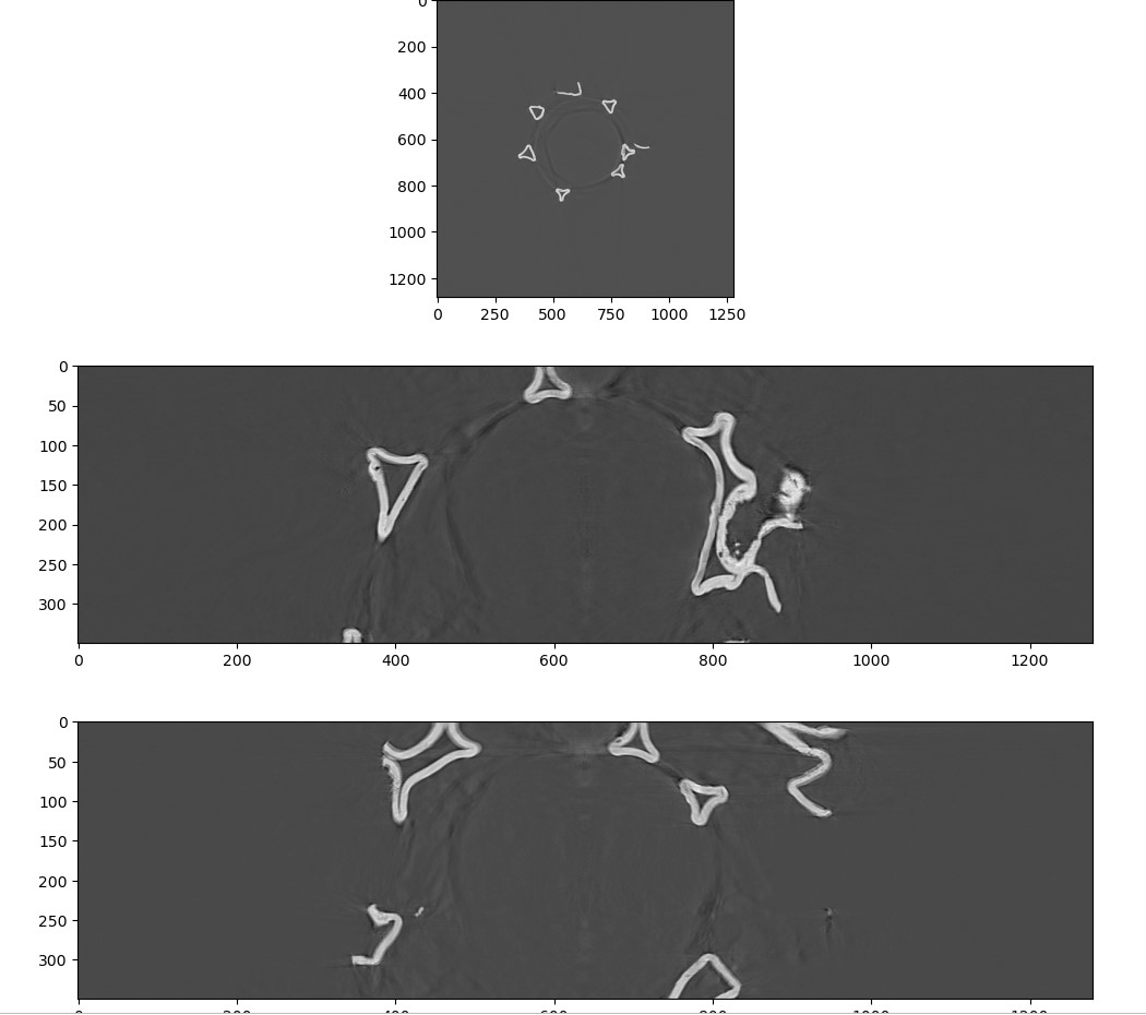 Trying 3D Reconstructruction of Metal foam from 2D Projections (X-ray images) but facing issue ...