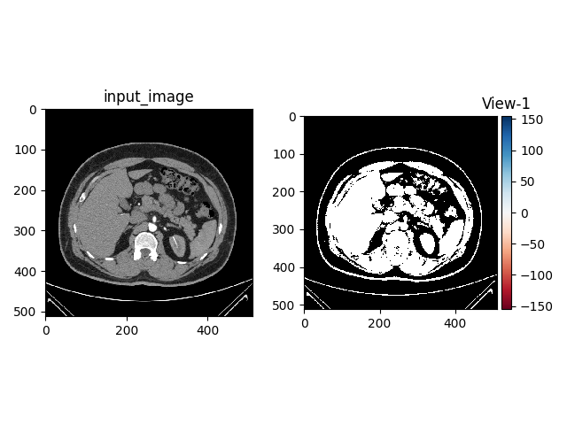 Github Yakeshkarthikey Functional Mri Tumor Detection Using Hybrid