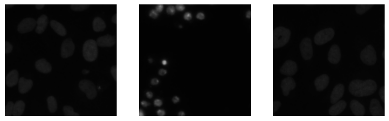 GitHub - deenazati08/Nuclei_Image_Segmentation